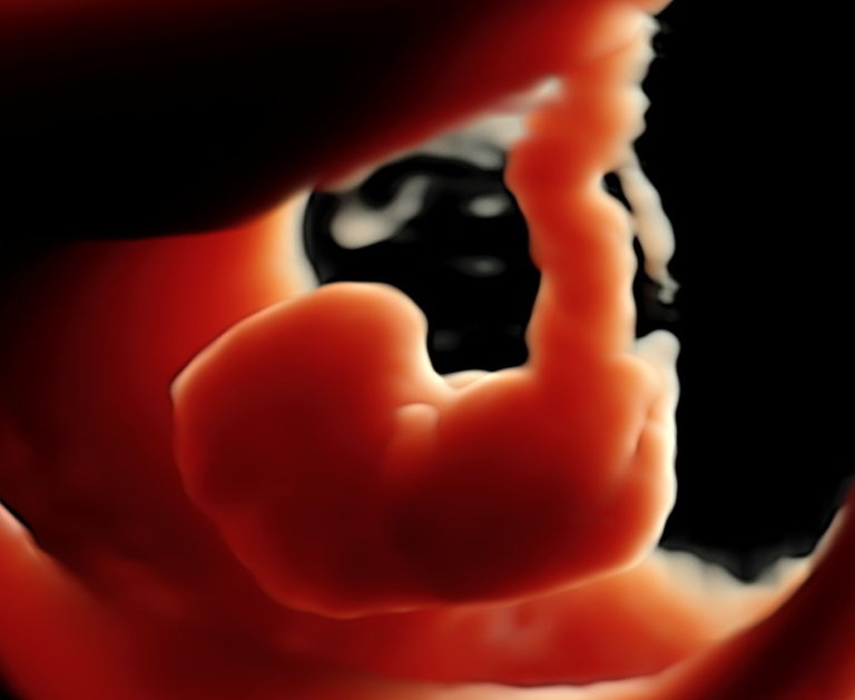 USG-5D HDLIVE - DOPPLER - MORFOLOGICA em ITABORAÍ |ULTRASSONOGRAFIA PLAZA