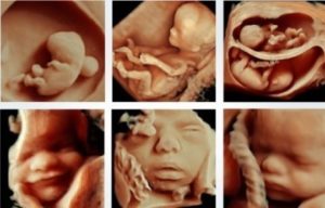 USG-5D HDLIVE - DOPPLER - MORFOLOGICA em ITABORAÍ |ULTRASSONOGRAFIA PLAZA